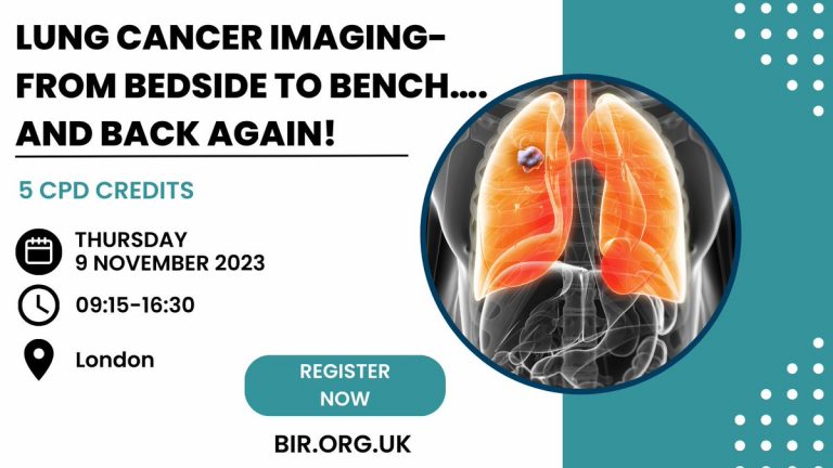 Lung cancer imaging- From bedside to bench…. and back again! - NCITA